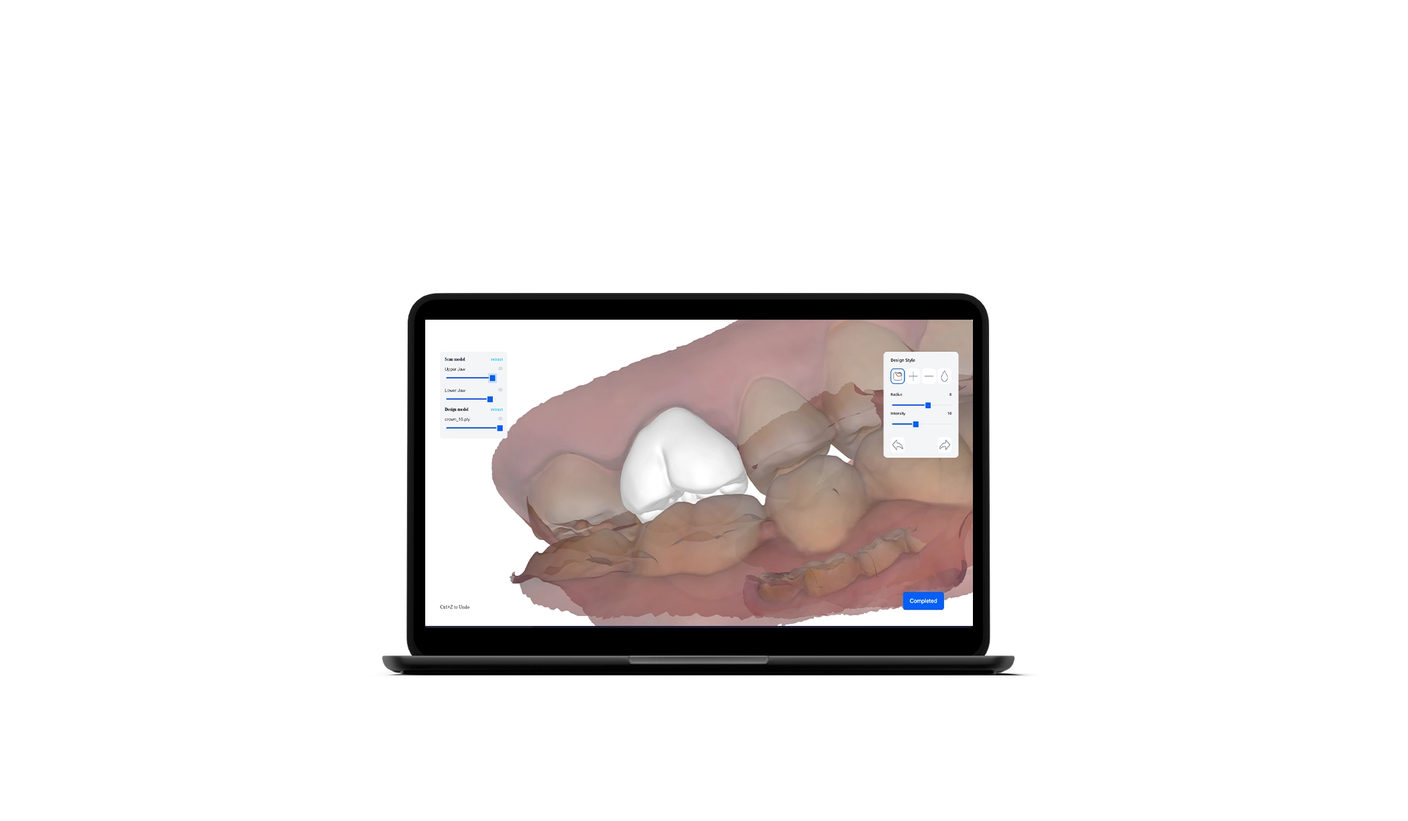 UP3D Lab Solution | Complete Dental CAD/CAM Workflow for Every Lab
