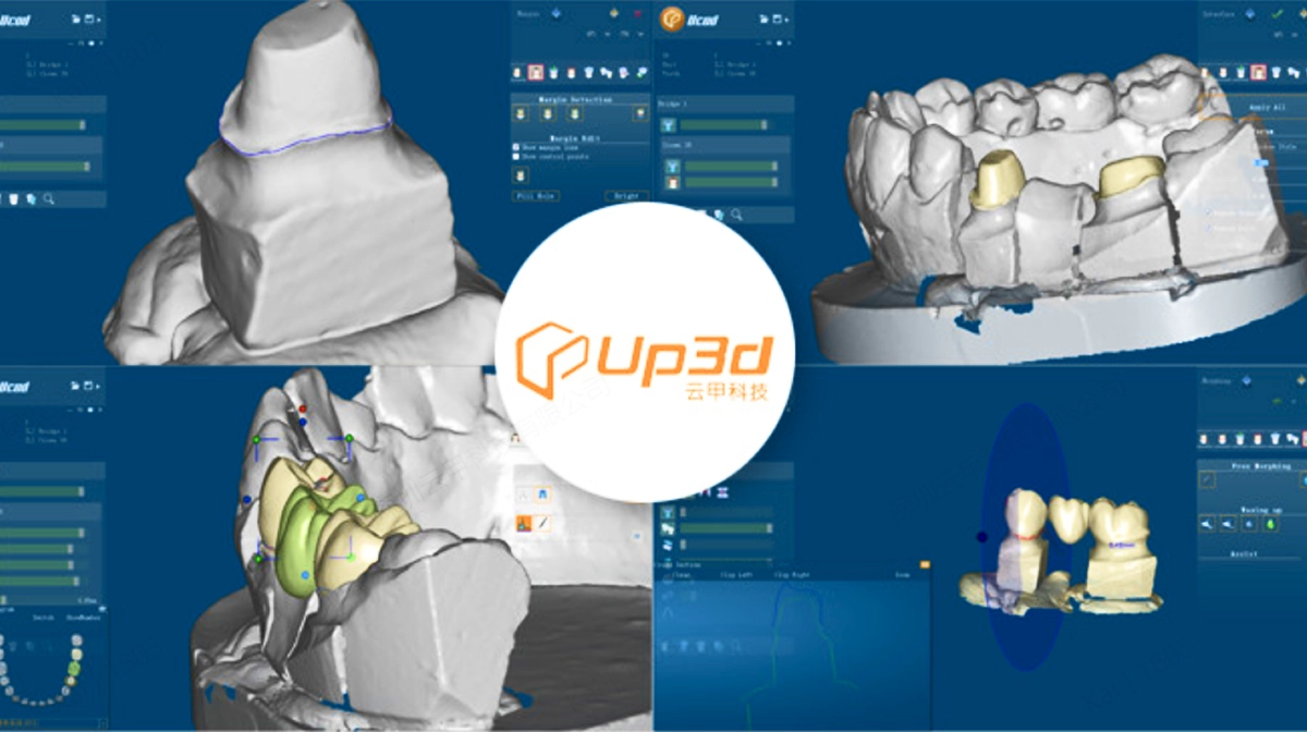 About UP3D | Global Leader in Digital Dentistry & CAD/CAM Solutions