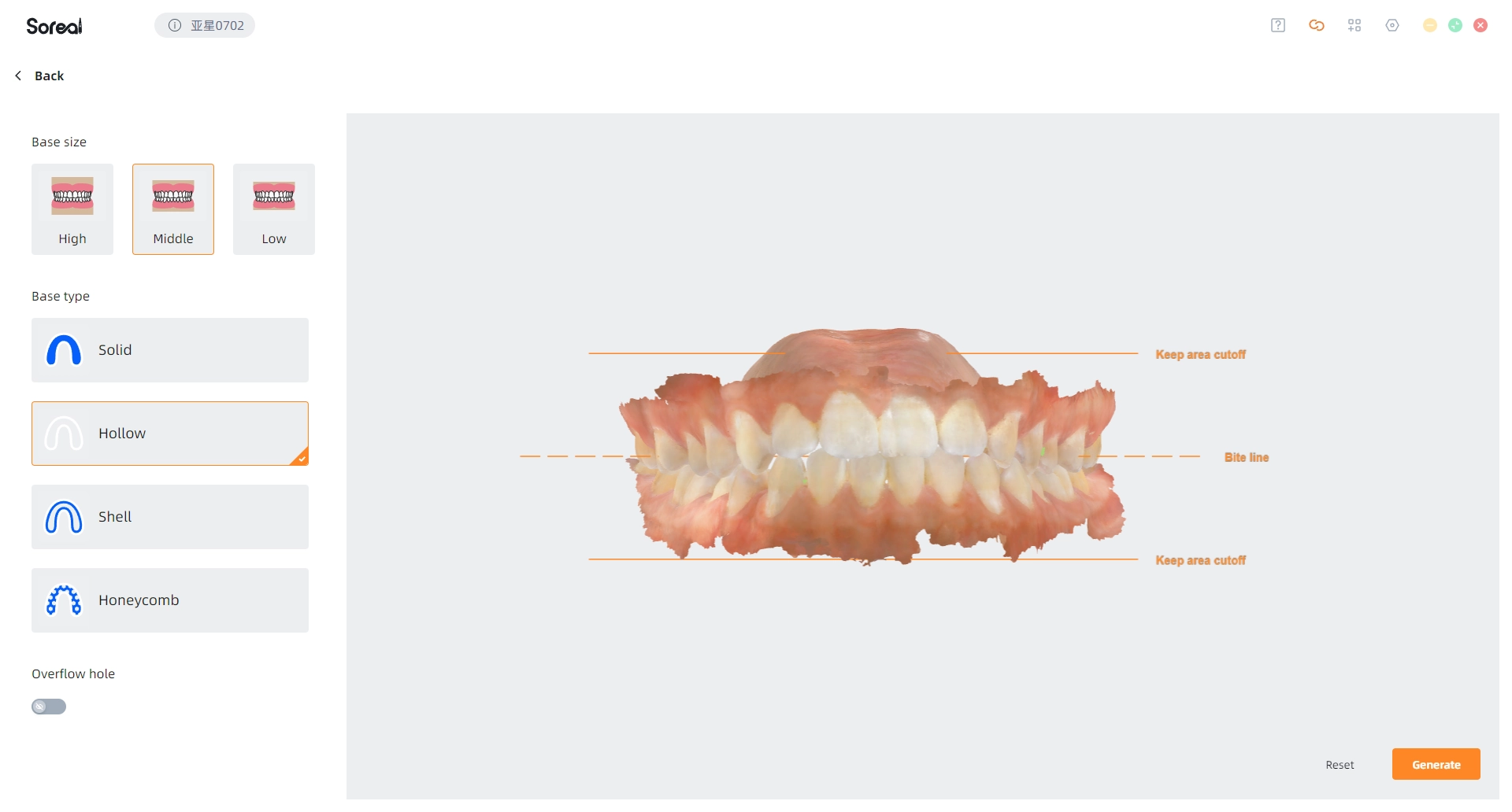 UP610 Intraoral Scanner | High-Precision, Lightweight & Fast Scanning ...