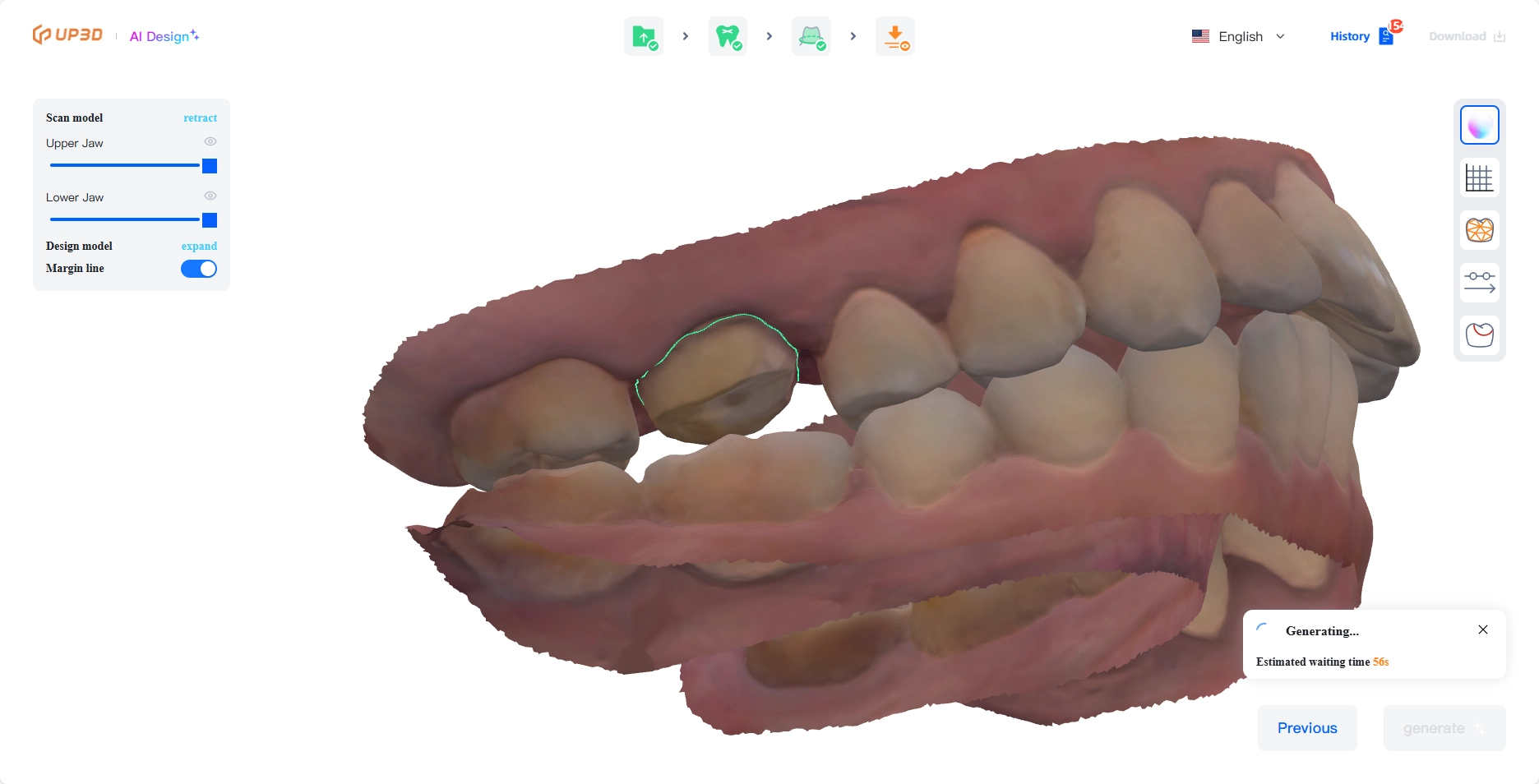 UP3D AI CAD | Web-Based AI Dental Design – 30-sec Crowns